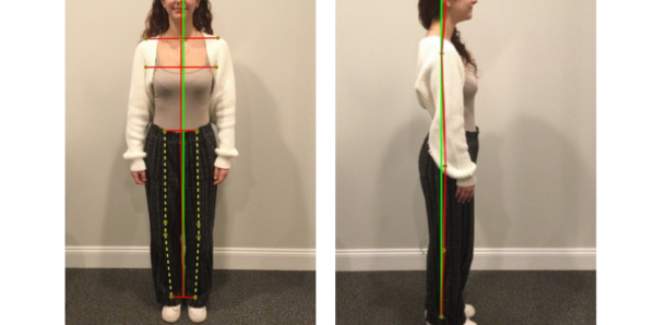 Posture Analysis in Clifton, NJ | Gardner Family Chiropractic